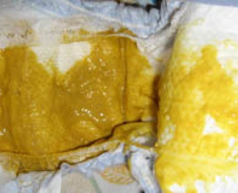 Waarom is babypoep knalgeel? | Willem Wever